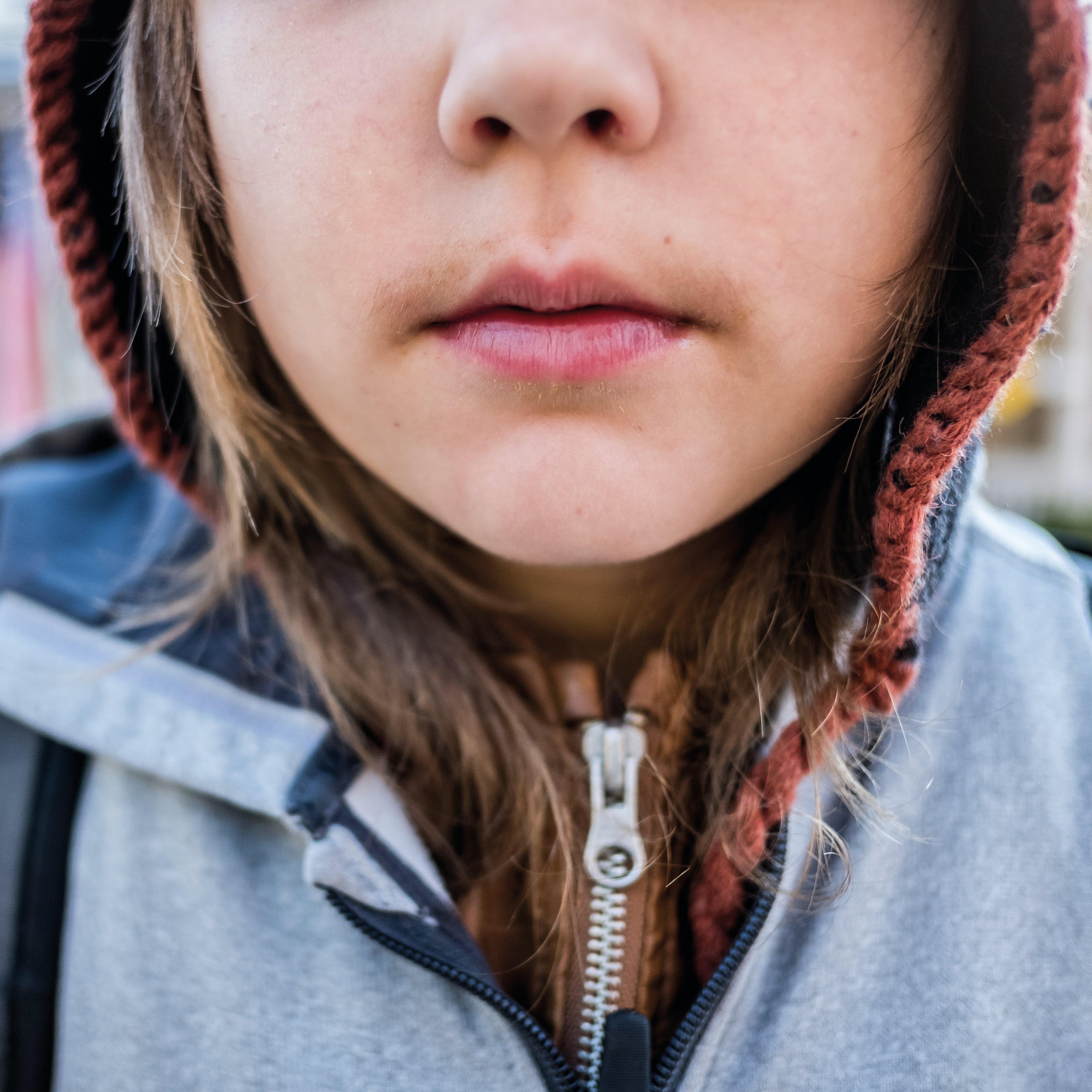 What is Impetigo? | Boots