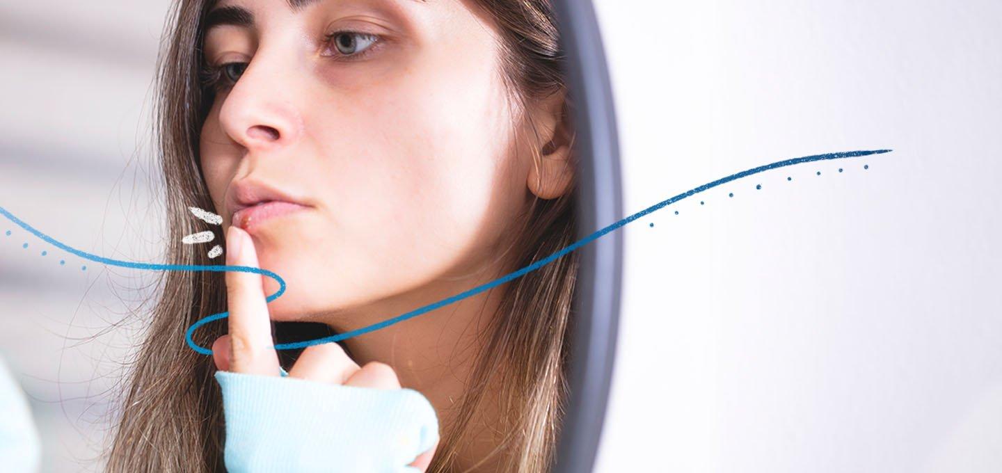 The difference between cold sores & impetigo | Boots