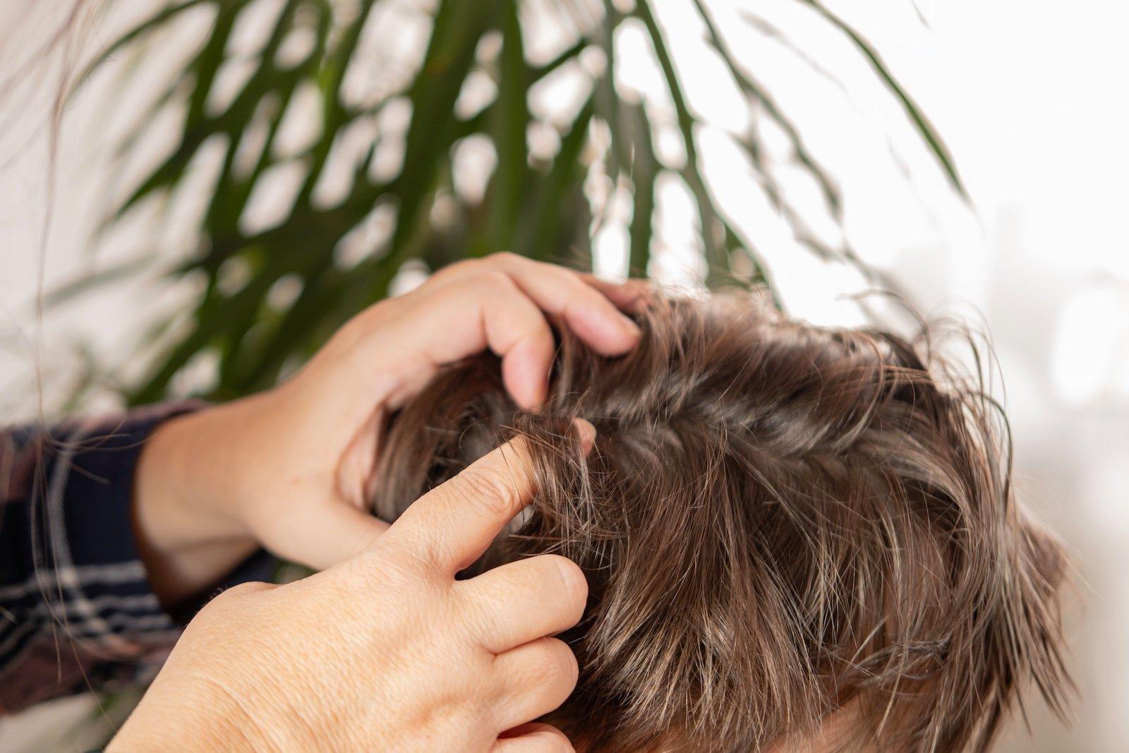 Head Lice: Advice & Management - Boots Health Hub | Boots