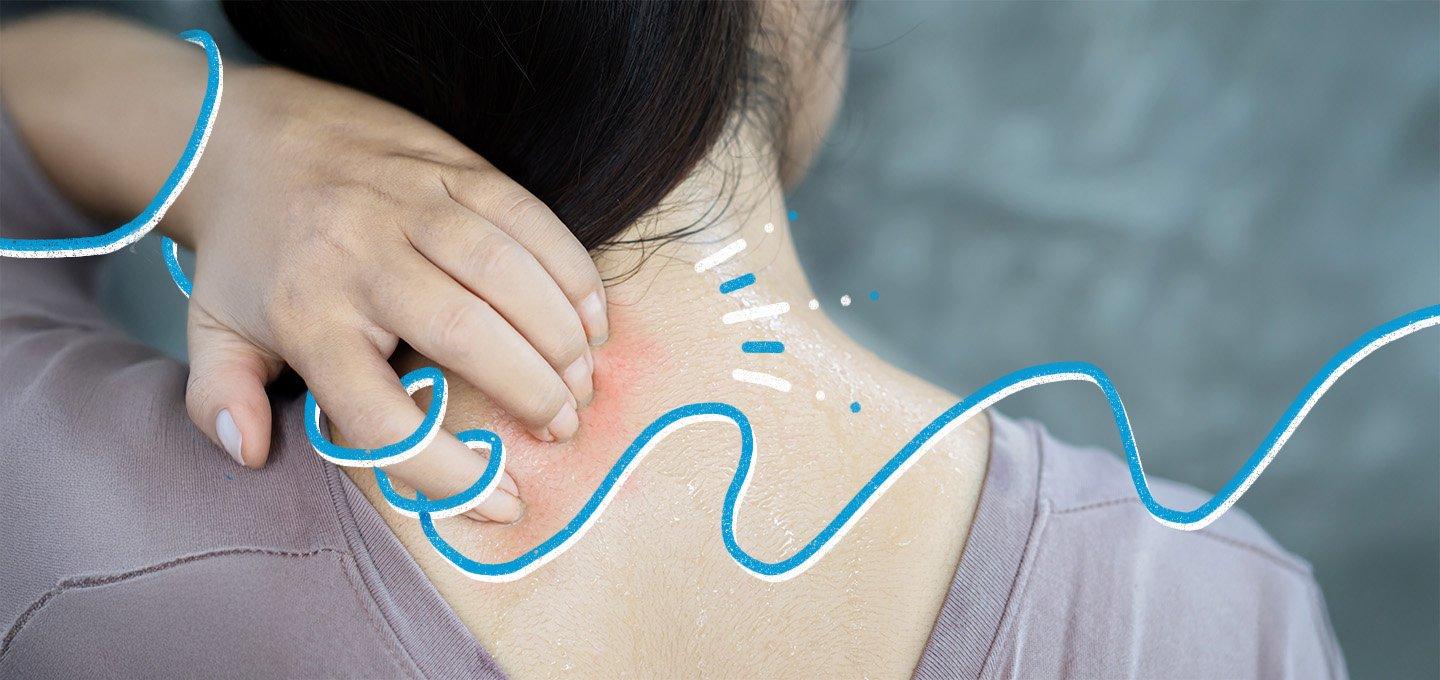 Itchy skin – Boots Health Hub | Boots