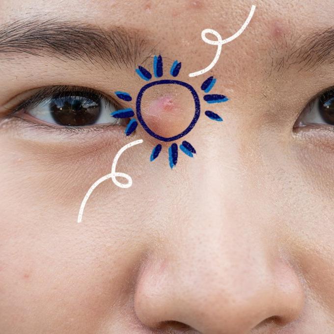 Skin Conditions Services & Advice - Boots Health Hub | Boots