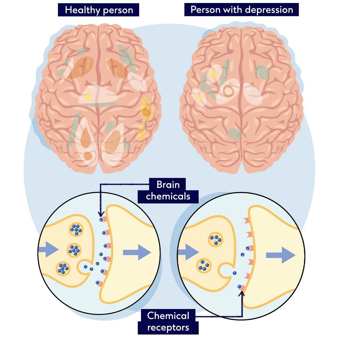 Depression - Boots Health Hub | Boots